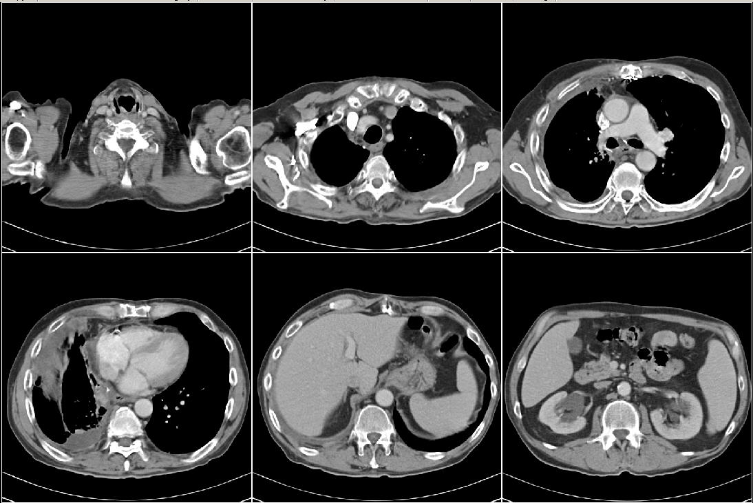 数据集 -- TCIA-TCGA-OV 癌症CT影像数据 | 聚数力平台 | 大数据应用要素托管与交易平台